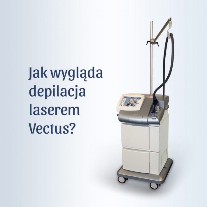 Laserowa depilacja Vectus - nowe możliwości - FD